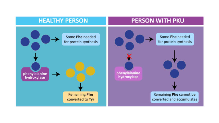 Phenylketonuria (PKU)- Treatment, Prevention, Dietary management ...