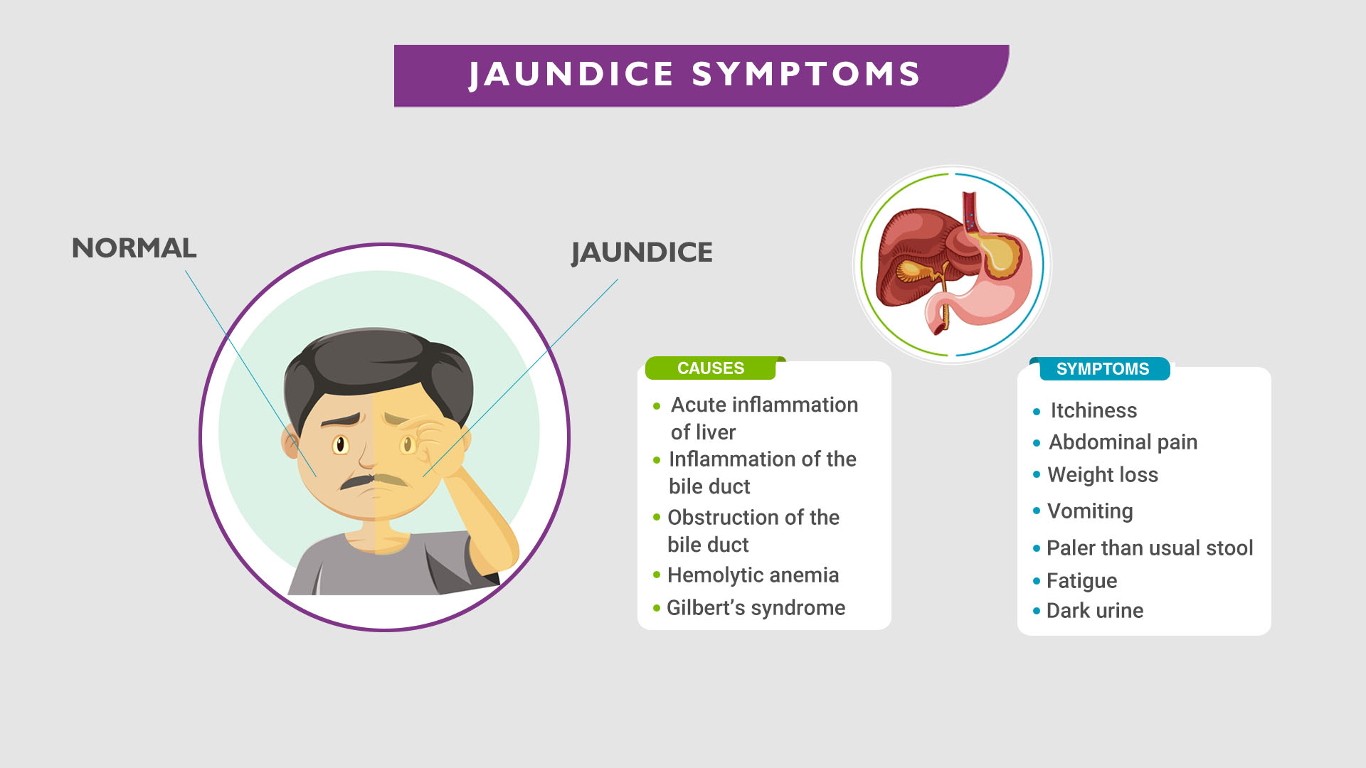 Jaundice Causes Symptoms Treatment NutritionFact in