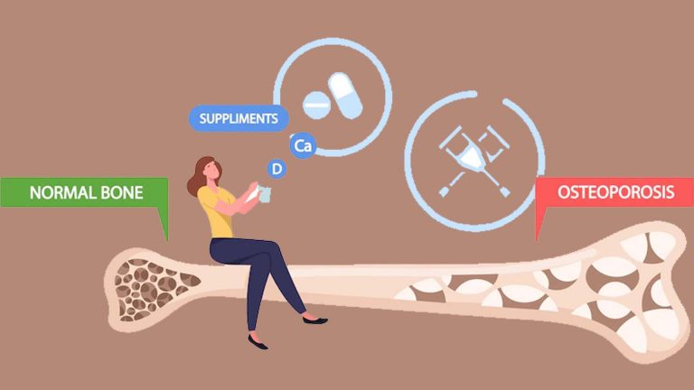 Osteoporosis Symptoms Causes Treatment And Foods To Be Taken 