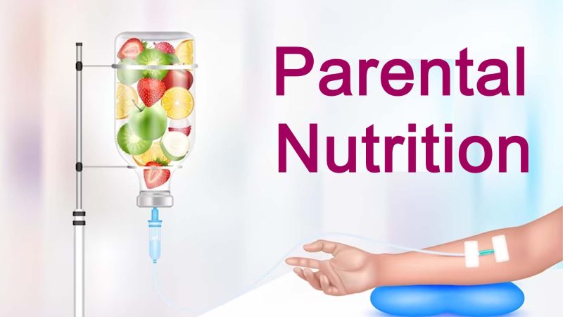 What is Total Parenteral Nutrition? – NutritionFact.in