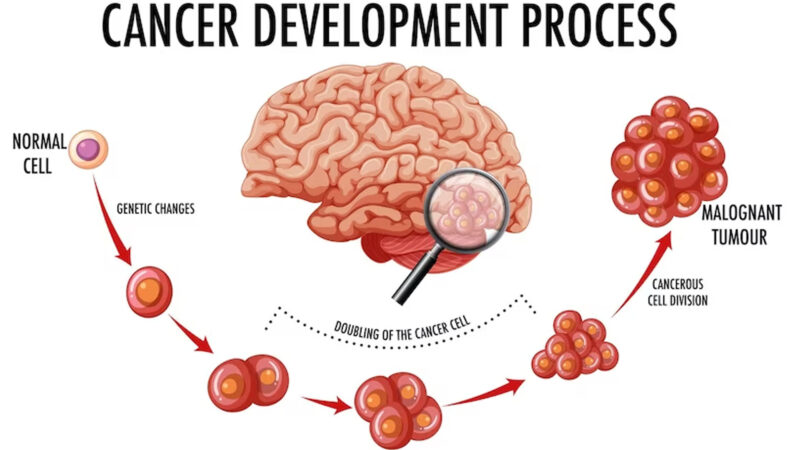 What are the Symptoms of Bone Marrow Cancer? – NutritionFact.in