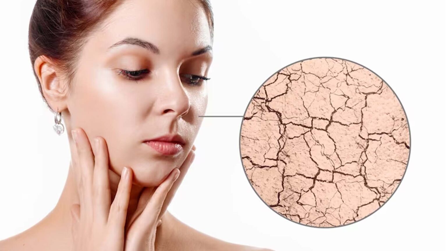 What Causes Dry Skin on Face? – NutritionFact.in