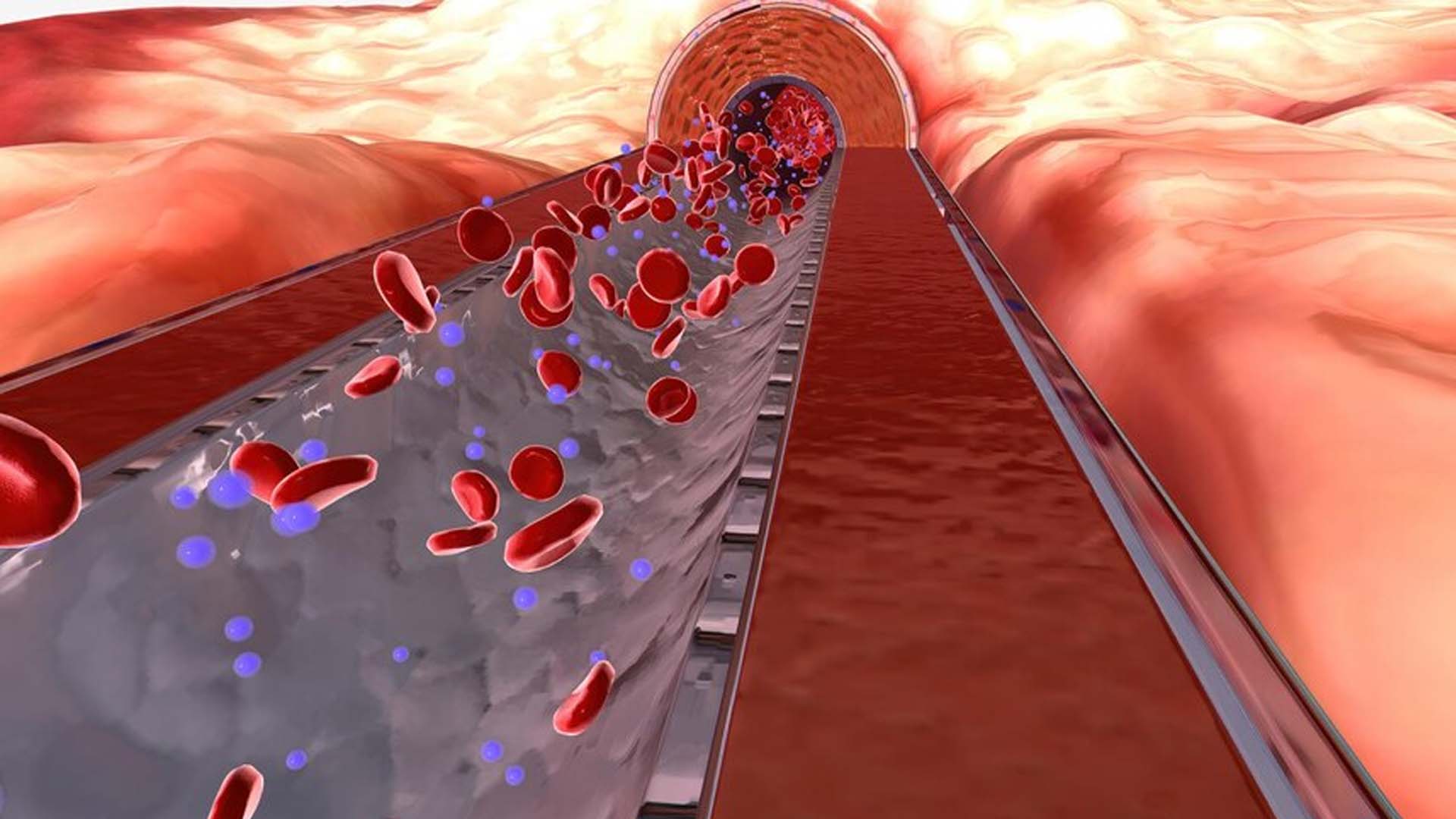 What Causes High In Potassium NutritionFact in What Causes High In Potassium NutritionFact in