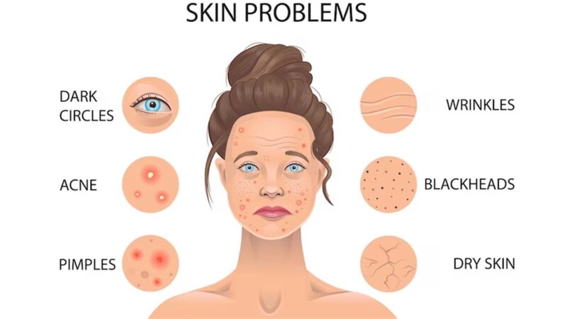 Which Vitamin Deficiency Causes Skin Problems? – NutritionFact.in