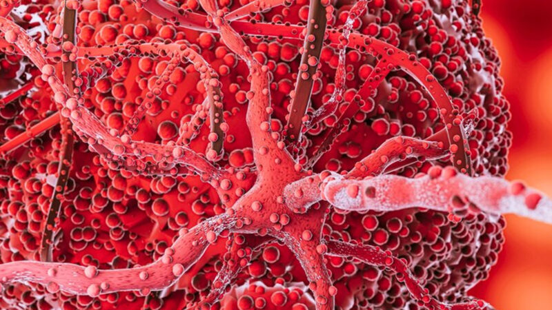 What are the Symptoms of High RDW? – NutritionFact.in