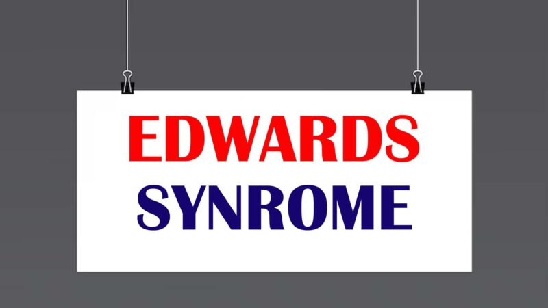 How is Edwards Syndrome Caused? – NutritionFact.in