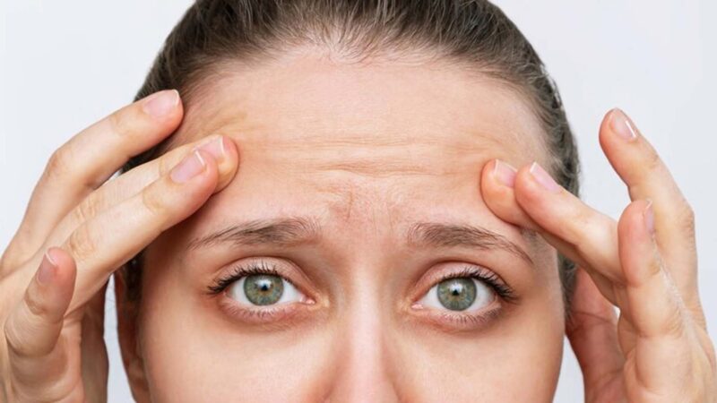 What Causes Forehead Wrinkles? – NutritionFact.in