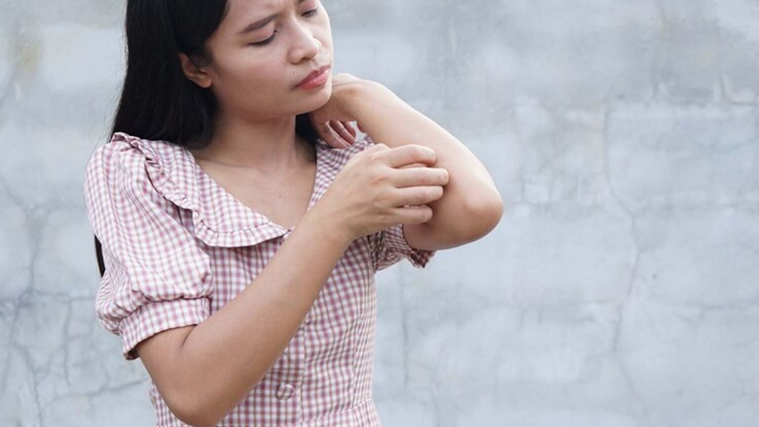 What Insect Bite Causes Swelling and Itching? – NutritionFact.in